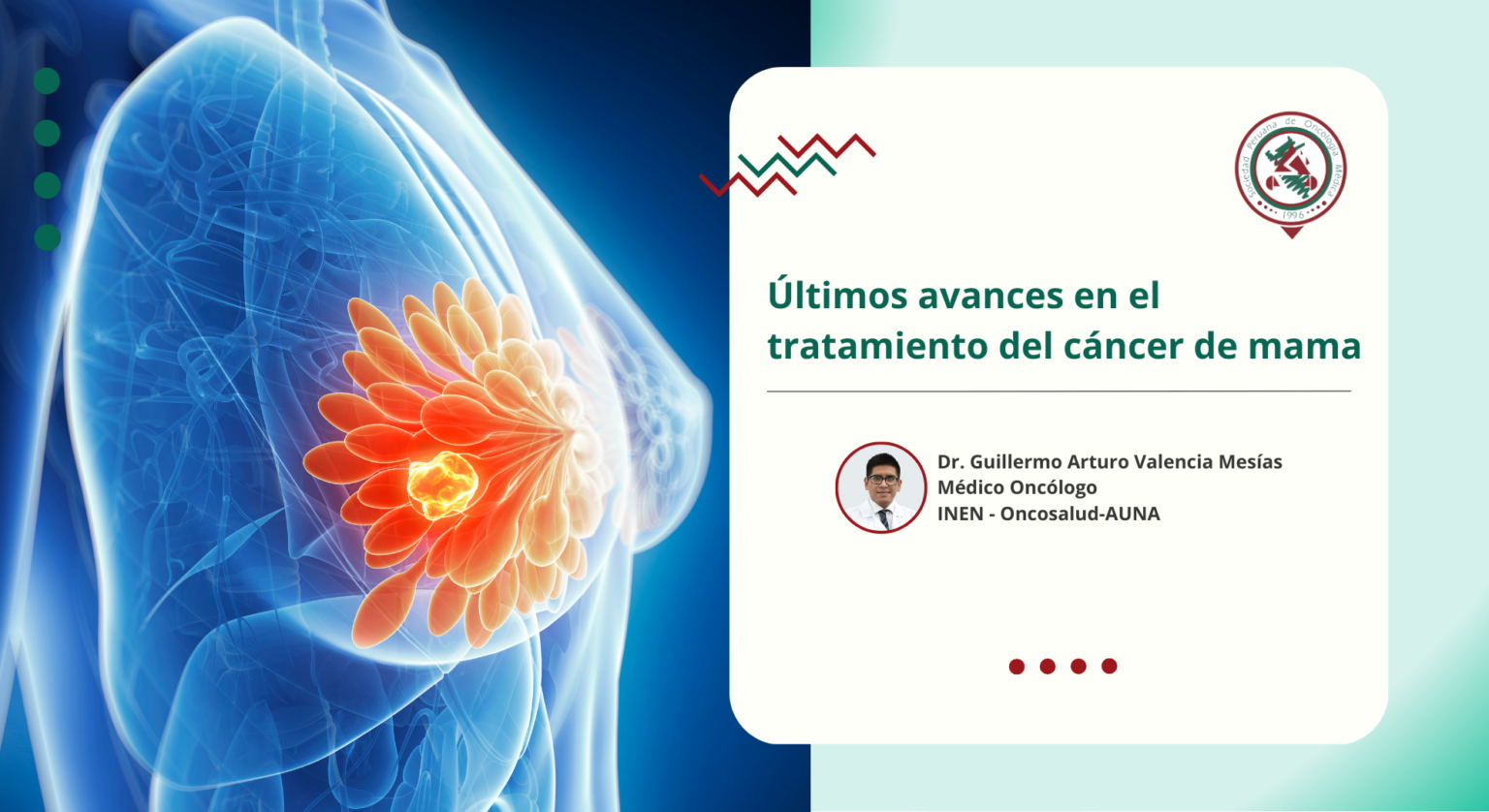 SARCOMAS – GENERALIDADES – DIAGNÓSTICO Y TRATAMIENTO - SPOM